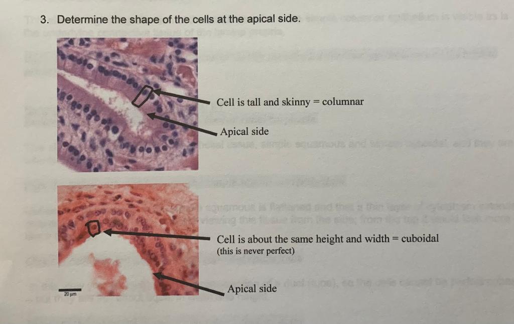 Solved 3. Determine the shape of the cells at the apical | Chegg.com
