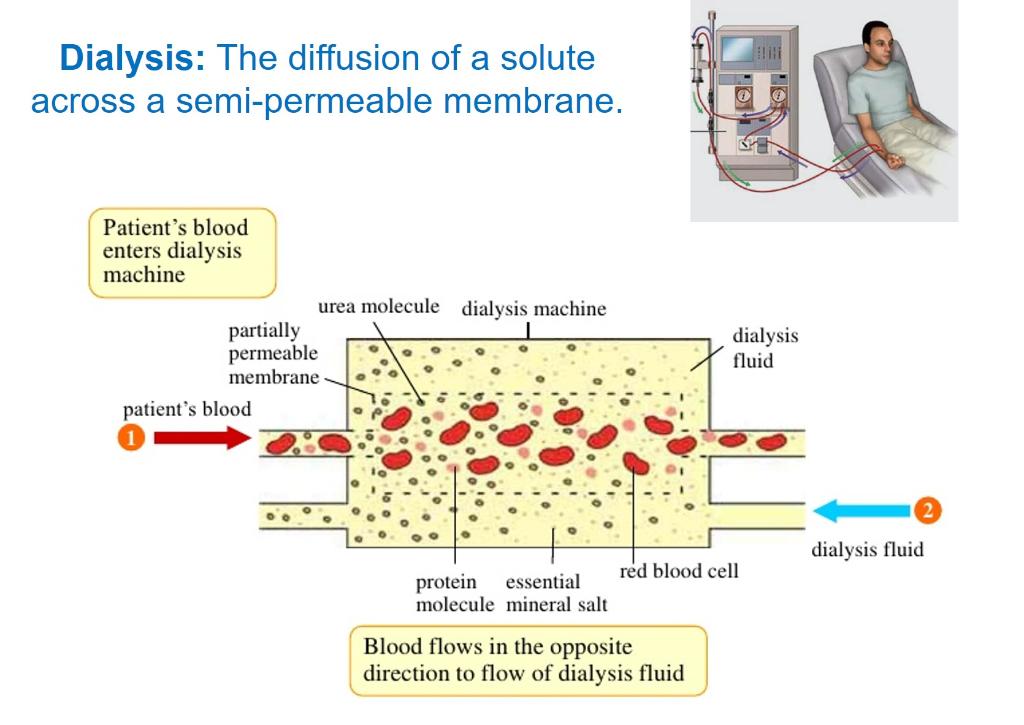 Hemodialysis Diffusion
