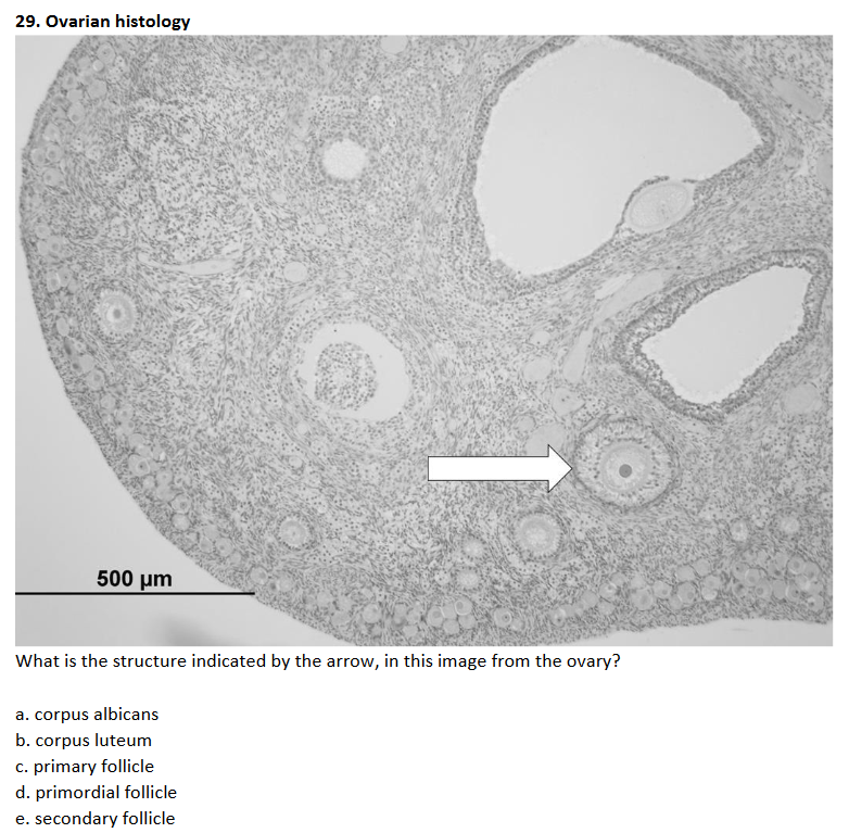 Solved 29. Ovarian histology 500 μm What is the structure | Chegg.com