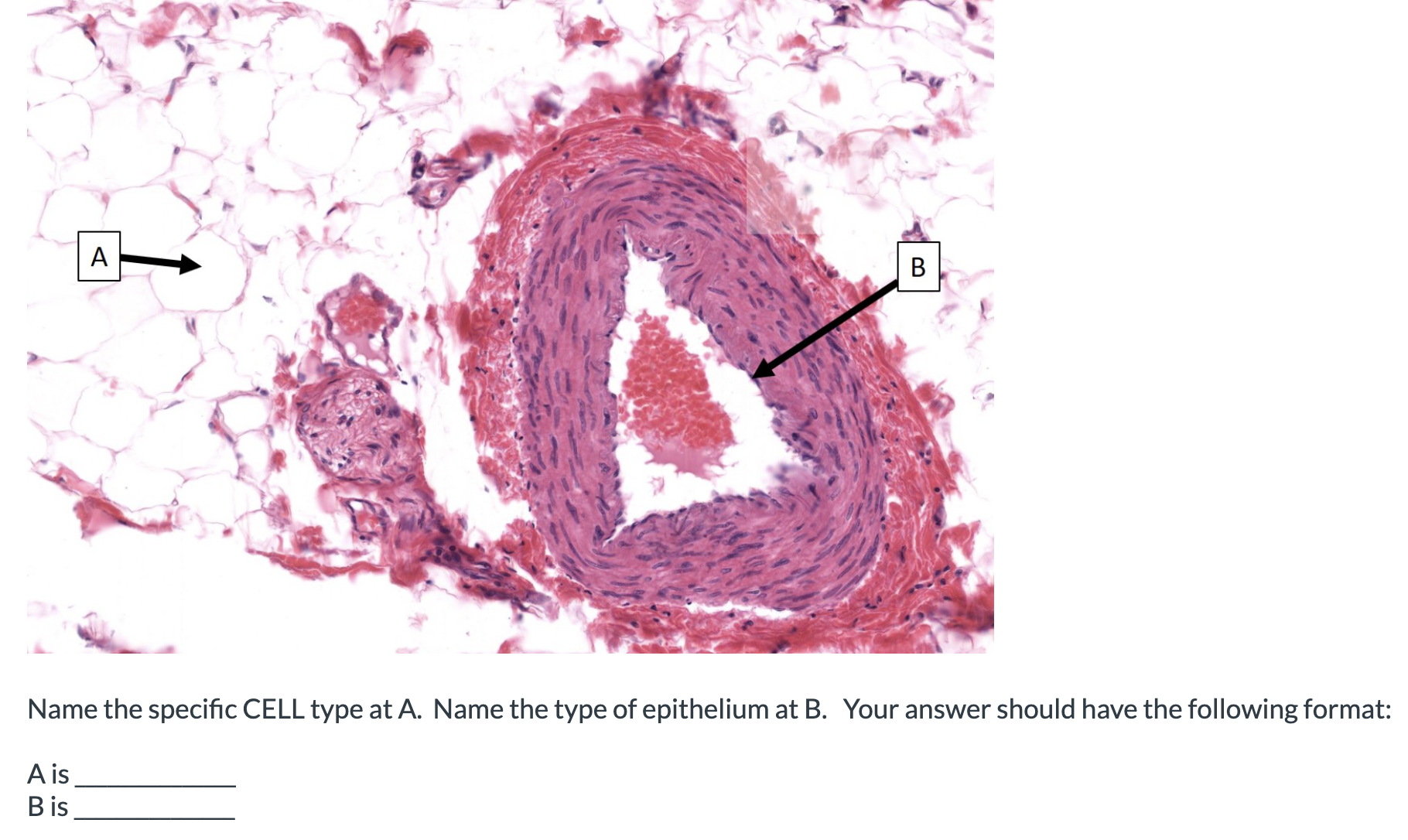 Solved Name the specific CELL type at A. Name the type of | Chegg.com