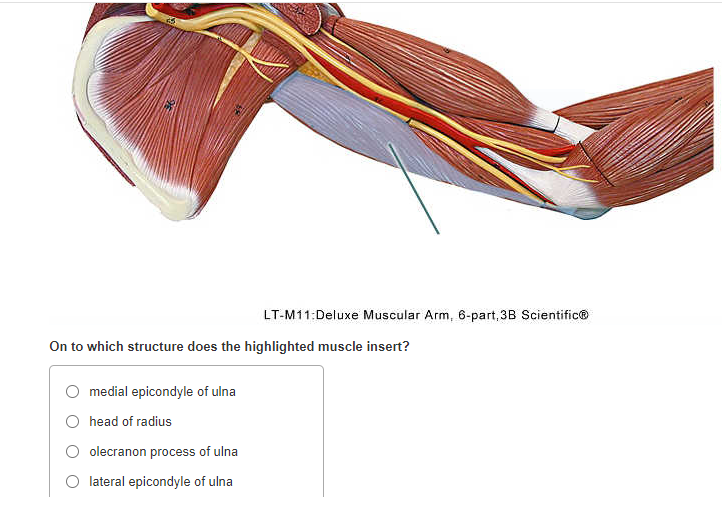 Solved LT-M11 Deluxe Muscular Arm, 6-part 3B Scientific® | Chegg.com