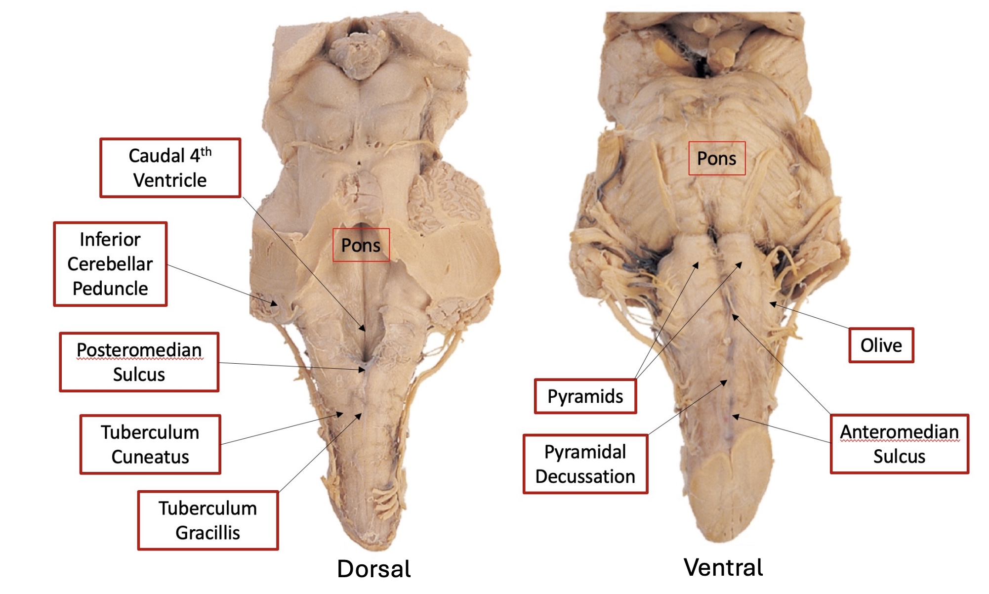 Solved What is the difference between the pyramidal | Chegg.com