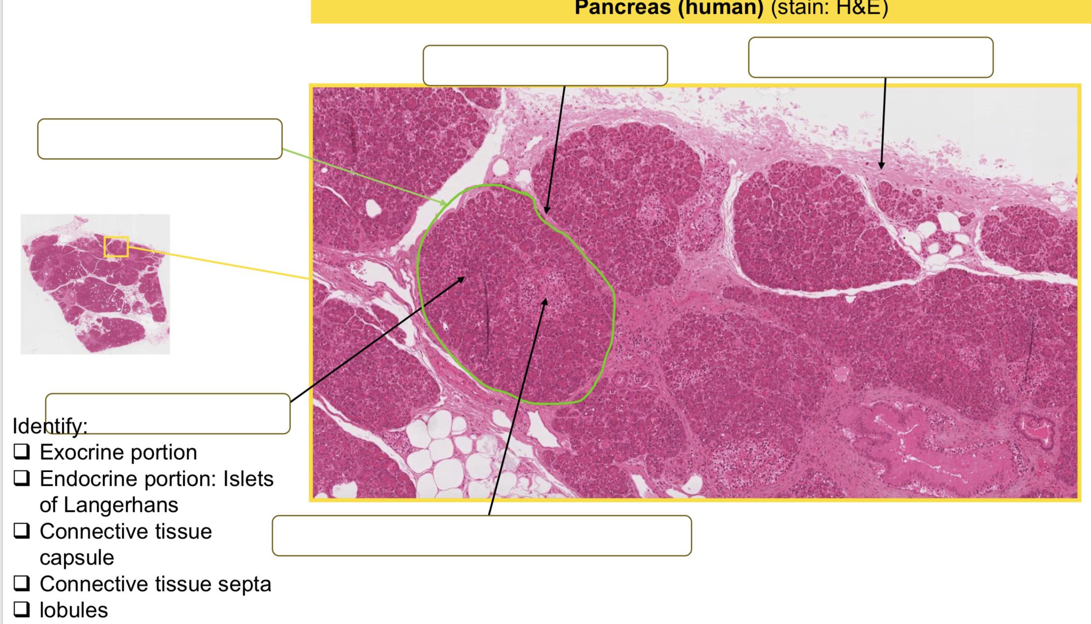 Solved Identify:Identify: Hepatocytes Kupffer cells | Chegg.com