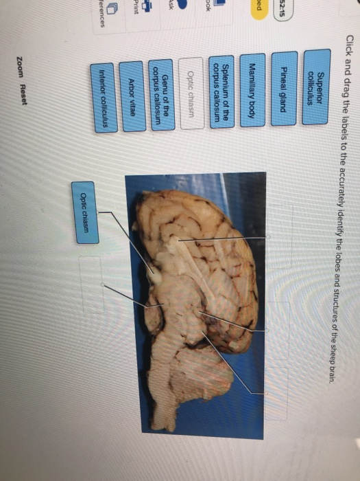 Superior Colliculus Sheep Brain