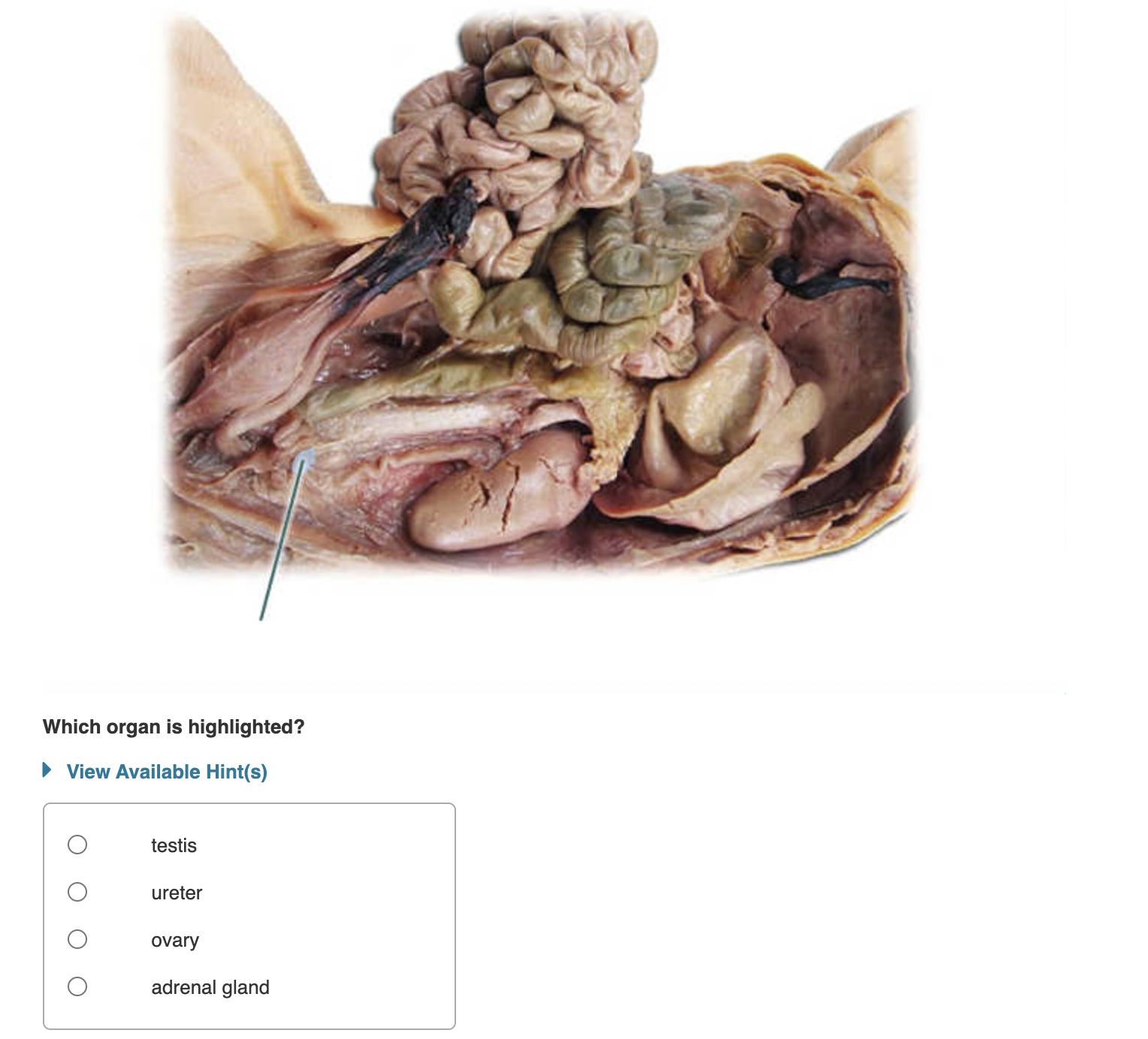 Solved Which organ is highlighted? This a female fetal pig. | Chegg.com