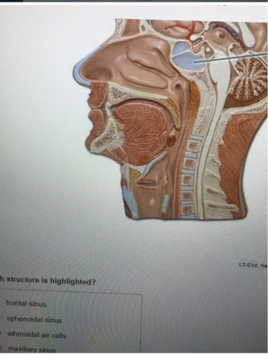 Solved 11:31 PM cricket Which structure is highlighted? | Chegg.com