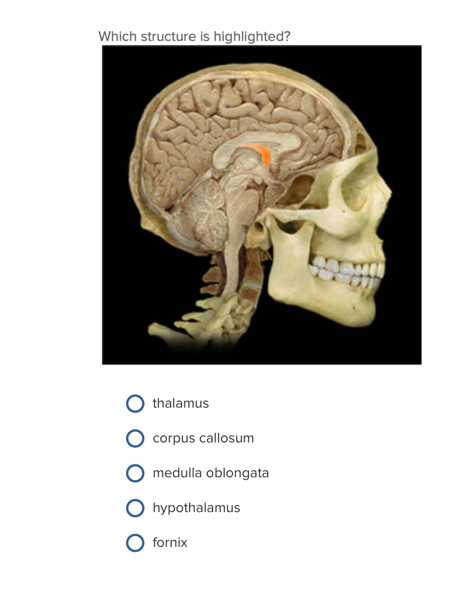 Solved Which structure is highlighted? third ventricle | Chegg.com