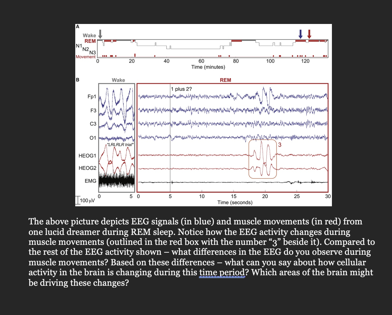 Solved The above picture depicts EEG signals (in blue) and | Chegg.com