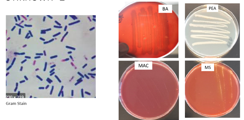 Solved 1. Describe what is in each plate. are they positive | Chegg.com