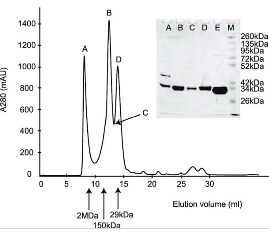 Solved B 1400 A B C D E M 1200 A 260kDa 135kDa 95kDa 72kDa | Chegg.com