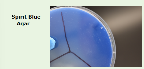 Solved Spirit Blue a. Clearing or no clearing: b. | Chegg.com