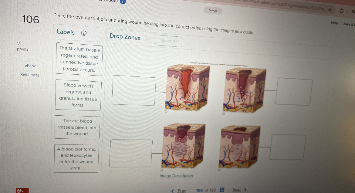 Solved 106pointseBookReferencesPlace the events that occur | Chegg.com