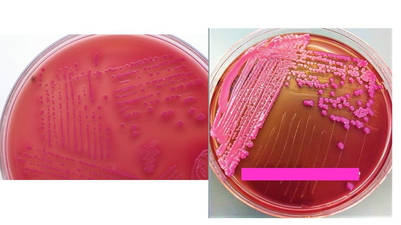 Enterobacter Cloacae Emb