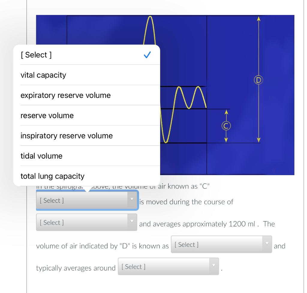 Solved Volume (ml) MW m In the spirogram above, the volume | Chegg.com