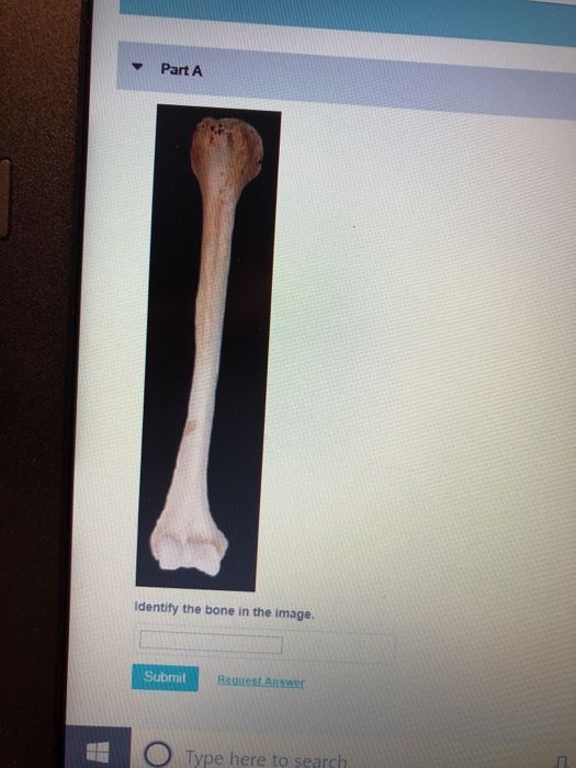 Solved Part A Identify the bone in the image. Submit Request | Chegg.com