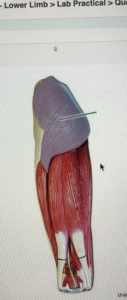 Solved - Lower Limb > Lab Practical > Que Lower Limb > Lab | Chegg.com