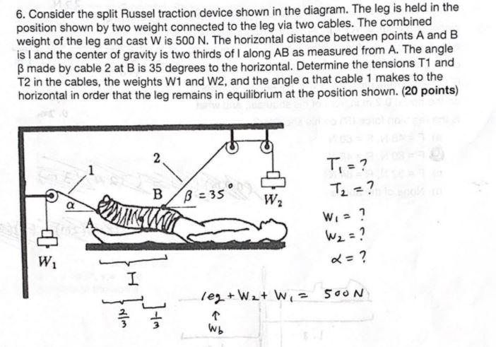 Solved 6. Consider the split Russel traction device shown in | Chegg.com