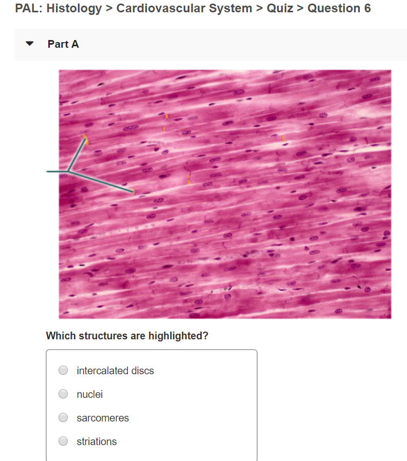 Solved PAL: Histology>Cardiovascular System> Quiz> Question | Chegg.com