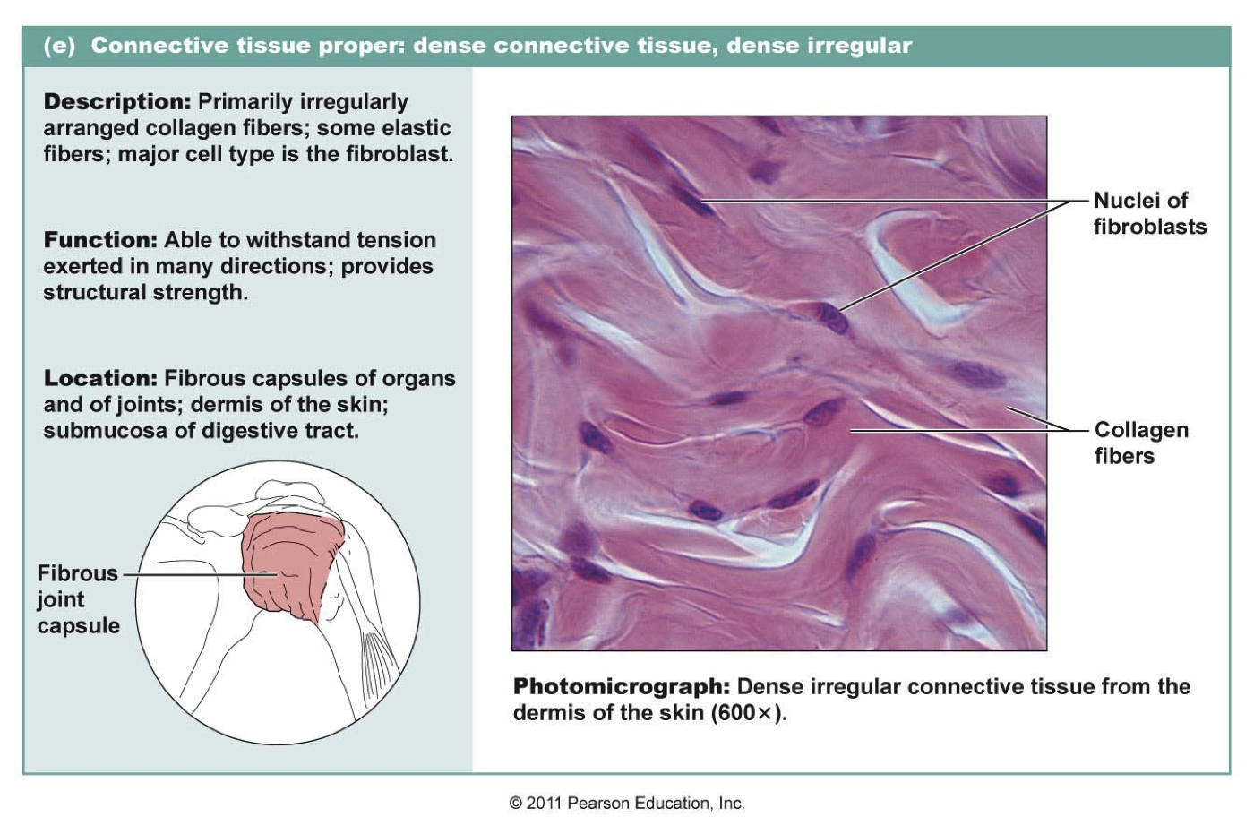 Dense Fibrous Connective Tissue Labeled