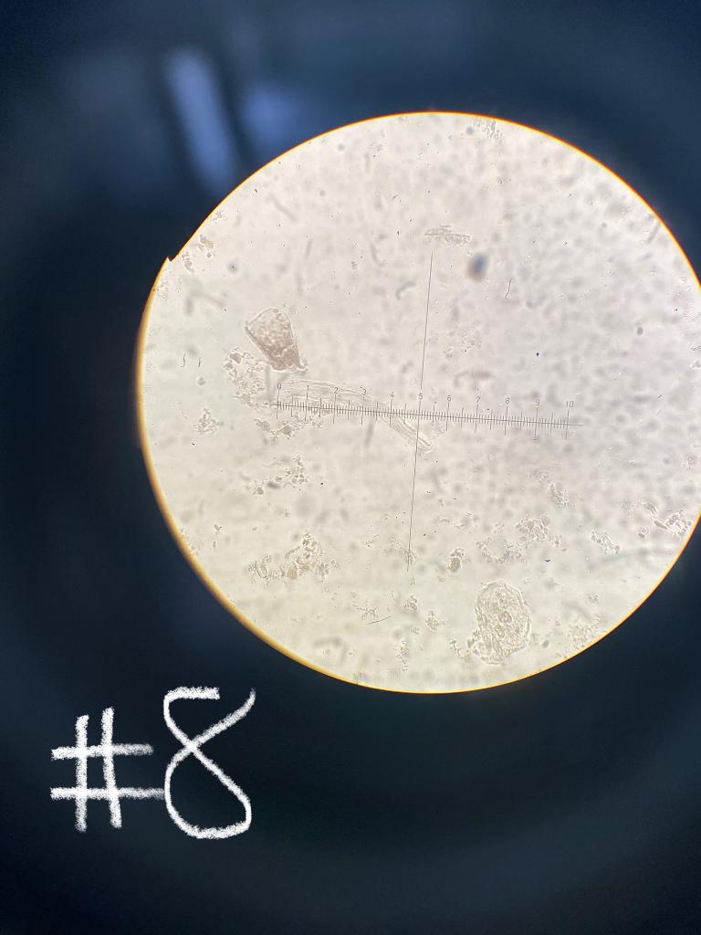 Solved Microscope slide #8 Fecal smear – unspecified stain | Chegg.com