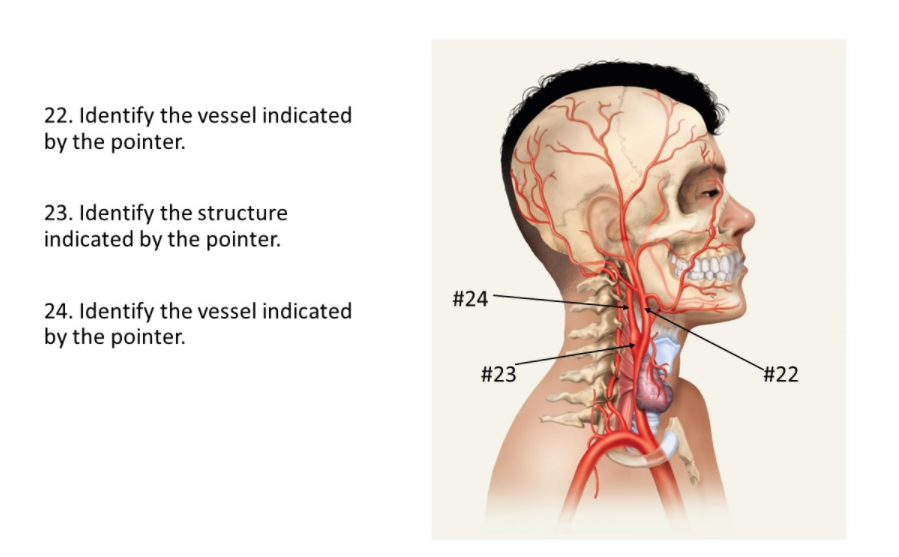 Solved 18. Identify the structure indicated by the pointer. | Chegg.com