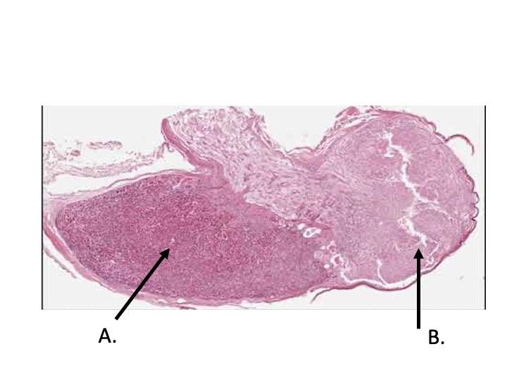 Solved identify the specific endocrine tissue indicated | Chegg.com