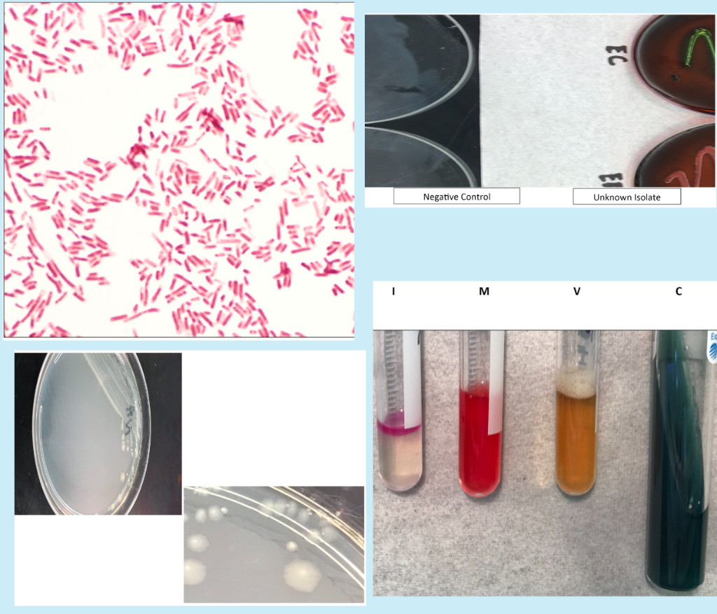 Solved Instructions 1.Samples from an ill patient were | Chegg.com