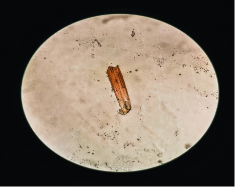 Solved Identify this free living protozoa in hay infusion. . | Chegg.com