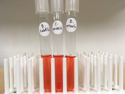 Phenol red carbohydrate broth Key to symbols and | Chegg.com