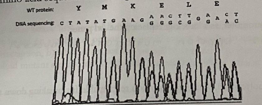Some mutations in the human HEXA gene are associated | Chegg.com