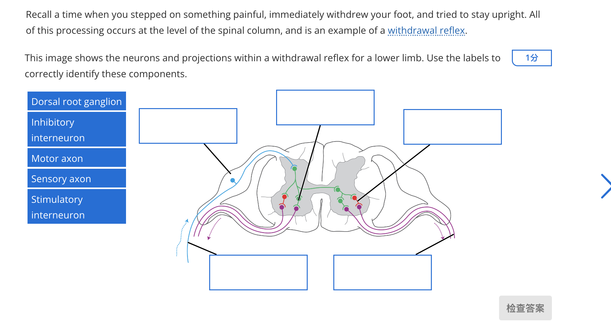 Solved atrophiedRecall a time when you stepped on something | Chegg.com