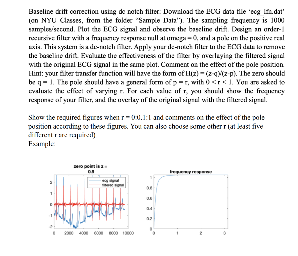 Solved Baseline drift correction using dc notch filter: | Chegg.com