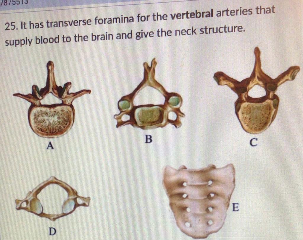 Solved 7875513 25. It has transverse foramina for the | Chegg.com