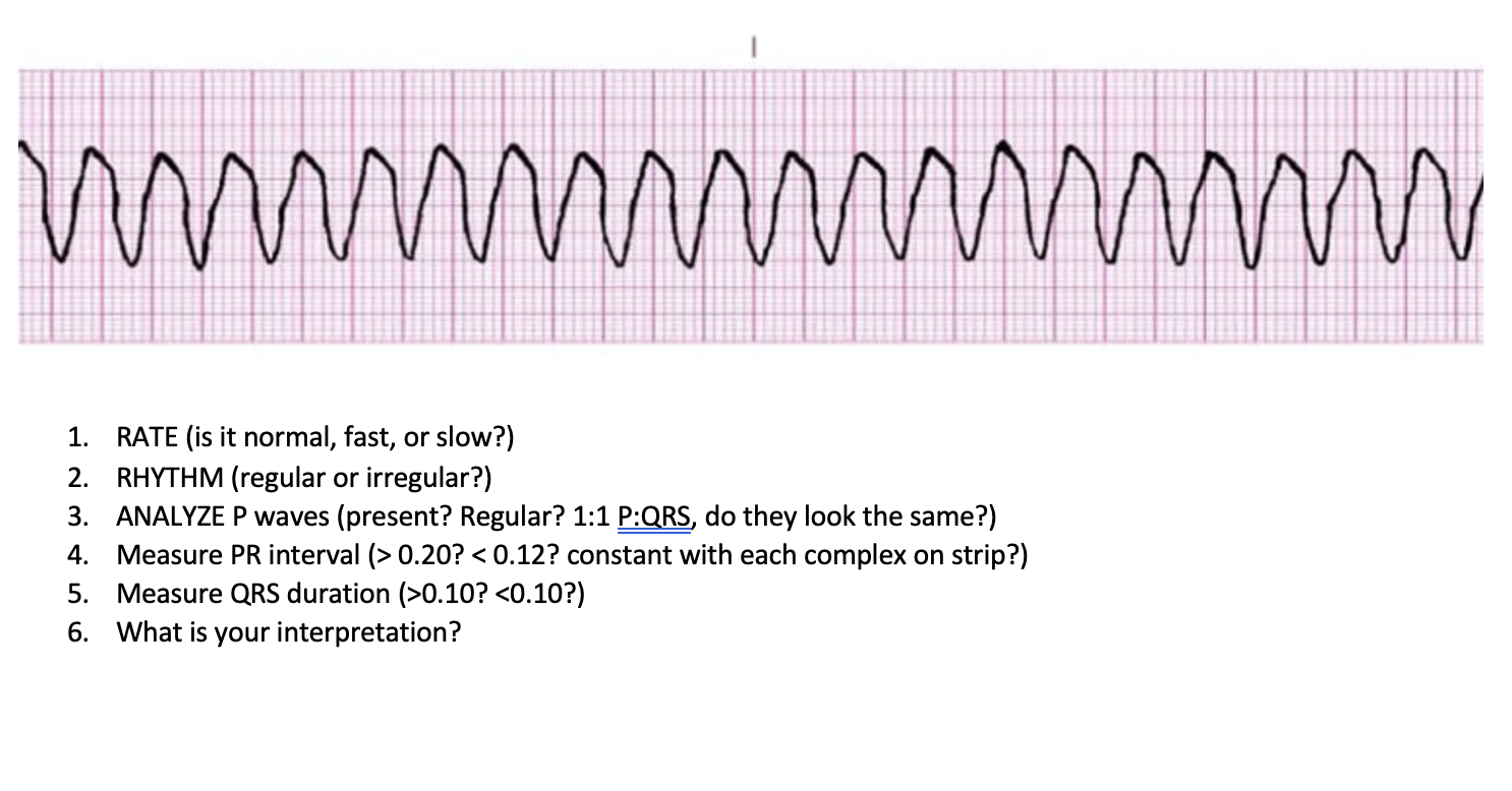 Solved 1. RATE (is it normal, fast, or slow?) 2. RHYTHM | Chegg.com