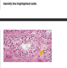 [Solved]: Identify the highlighted structure. Identify th
