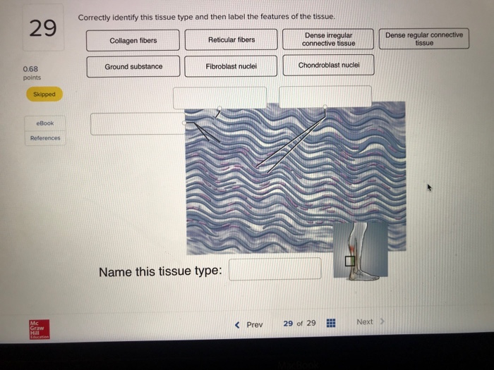 Solved Connect chapter 5 assignment (histology) Help | Chegg.com Solved Connect chapter 5 assignment (histology) Help | Chegg.com