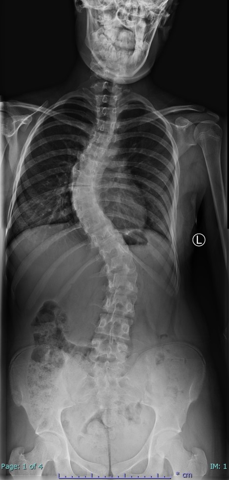 I need a Python program to implement Convolutional | Chegg.com