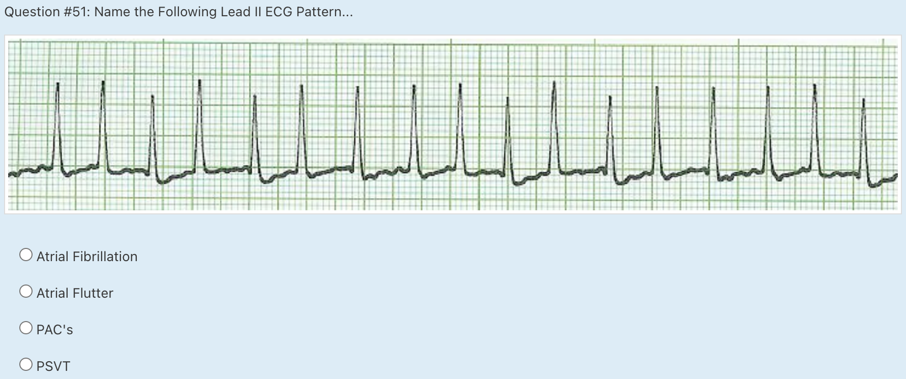 Solved Question #51: Name the Following Lead II ECG | Chegg.com