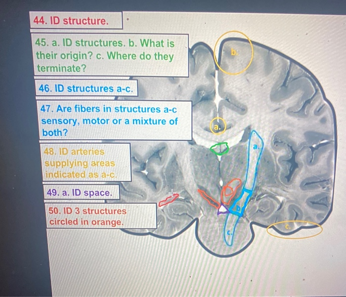 Solved 44. ID structure. 45. a. ID structures. b. What is | Chegg.com
