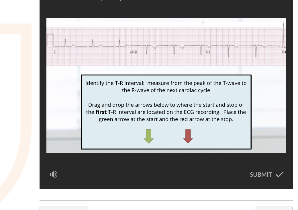 Solved n VR TH VE V Identify the T-R Interval: measure from | Chegg.com