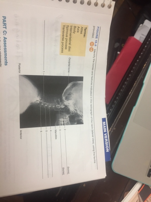Solved Identify the bones and features indicated in this | Chegg.com
