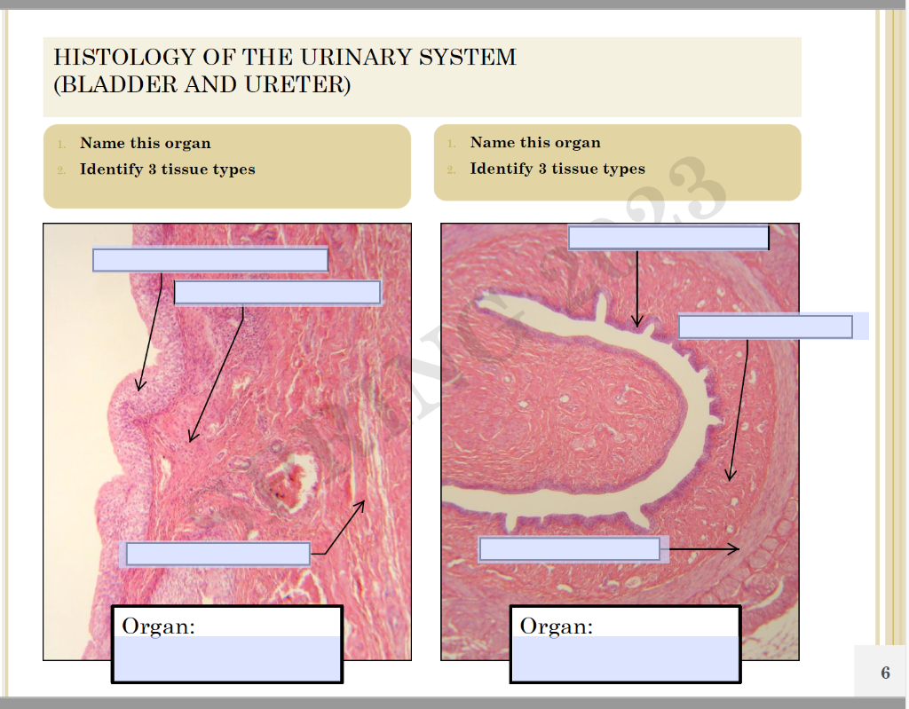 Solved HISTOLOGY OF THE URINARY SYSTEM (BLADDER AND URETER) | Chegg.com