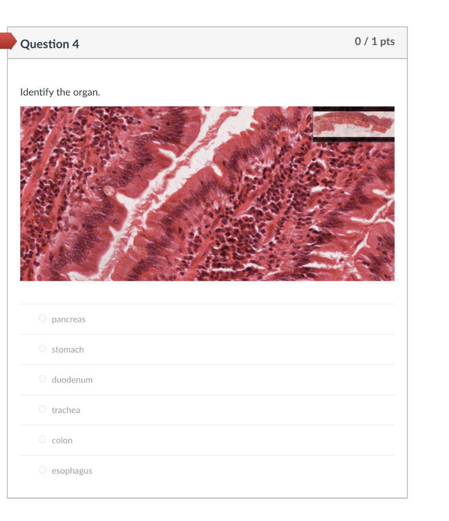 Solved Question 4 0 / 1 pts Identify the organ. pancreas | Chegg.com