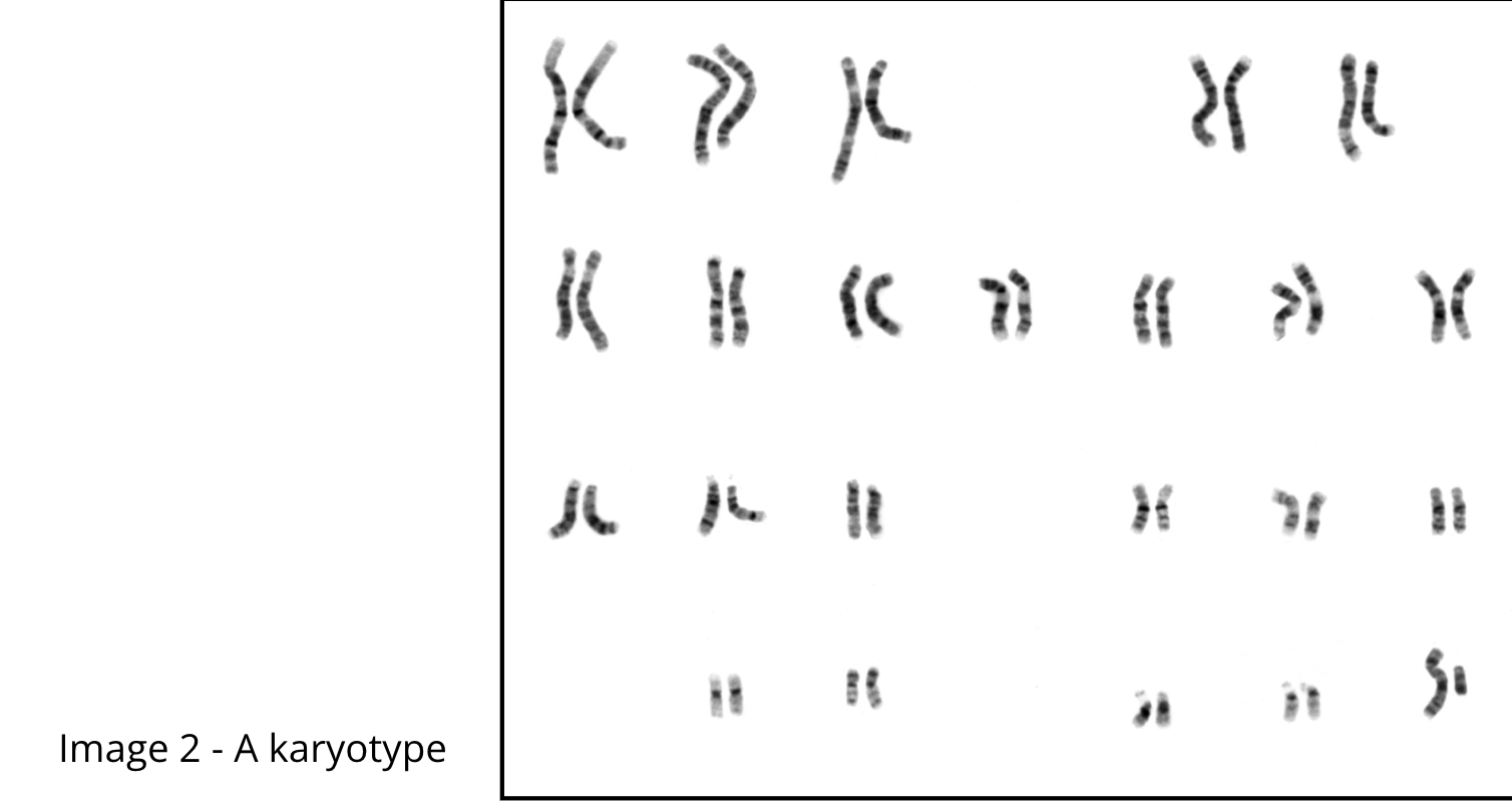 Solved Image 2 is of a karyotype with the numbers for the | Chegg.com