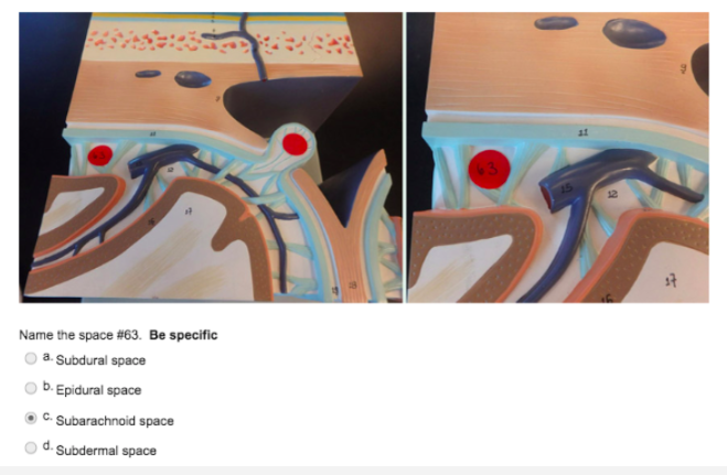 Solved st Name the space #63. Be specific a. Subdural space | Chegg.com