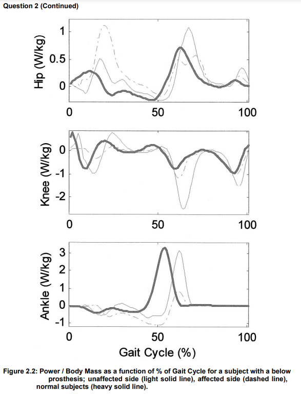 Solved 2 (a) Describe the main features of a transtibial | Chegg.com