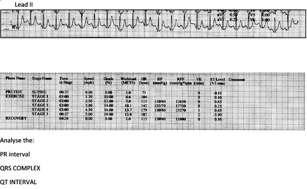 Solved Lead II = Analyse the: PR interval QRS COMPLEX QT | Chegg.com