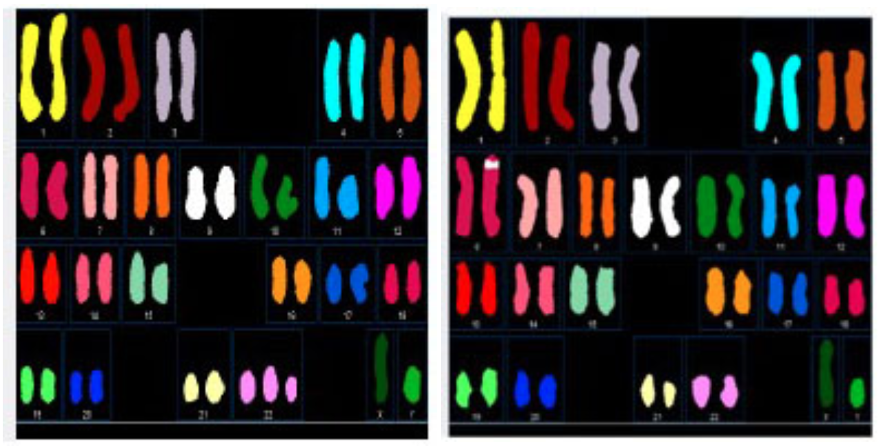 Solved How do you interpret the spectral karyotyping of | Chegg.com
