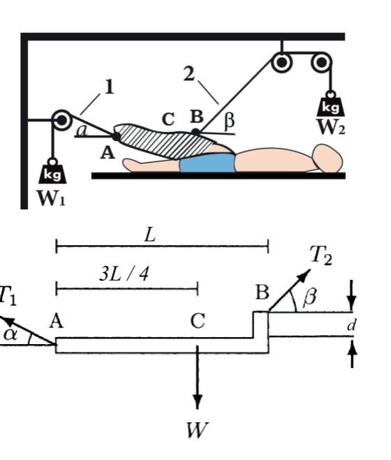 Solved Question 2) The figure shows Russell's fracture | Chegg.com