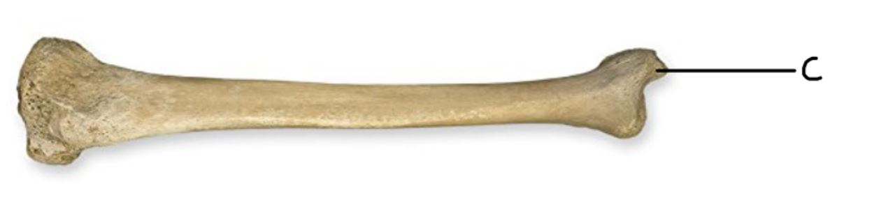 Solved What bone is this and what is the part called | Chegg.com